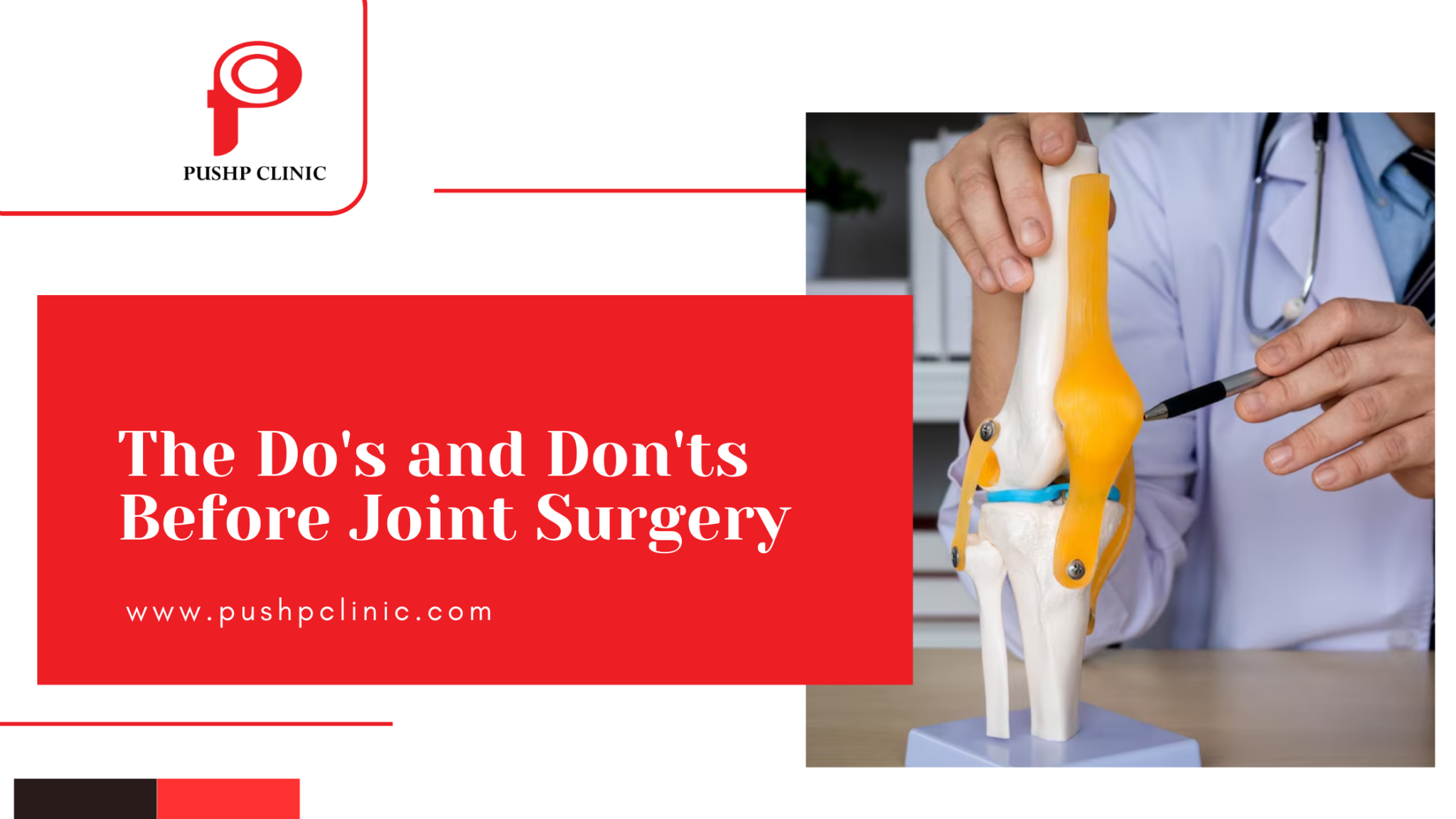The Do's and Don'ts Before Joint Surgery