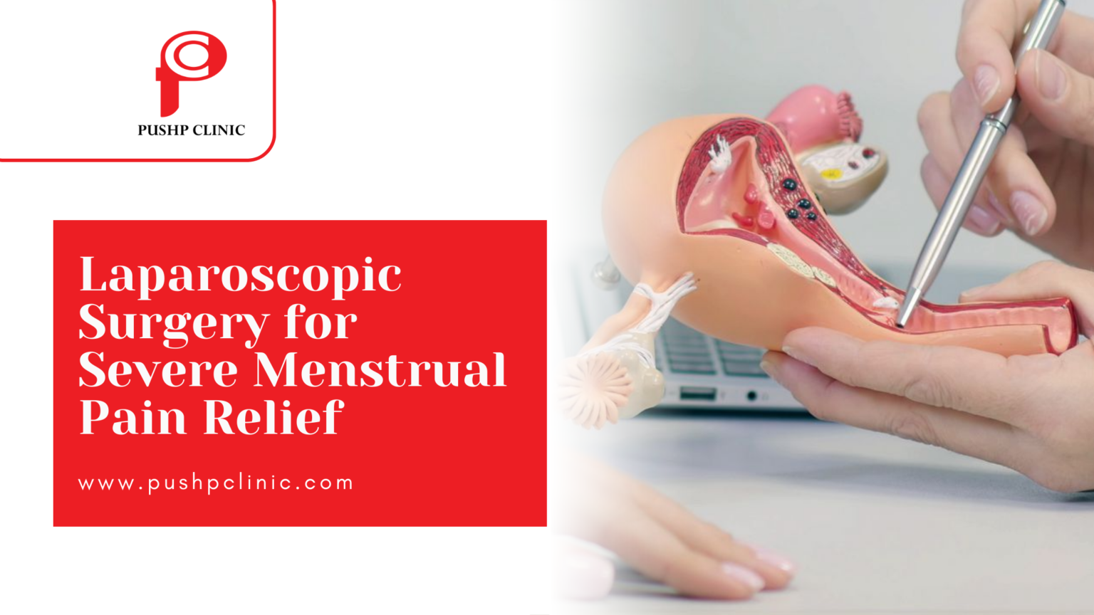 Laparoscopic Surgery for Severe Menstrual Pain Relief